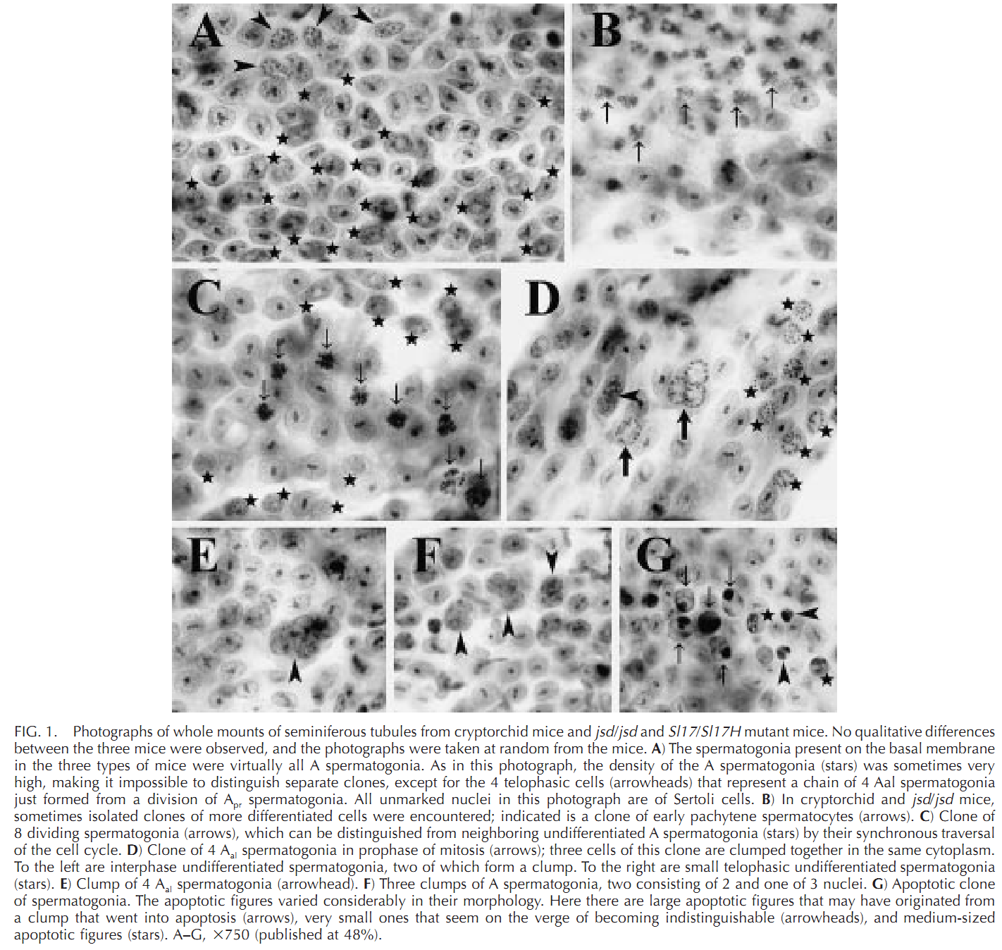 FertilityOnline | Spermatogenes