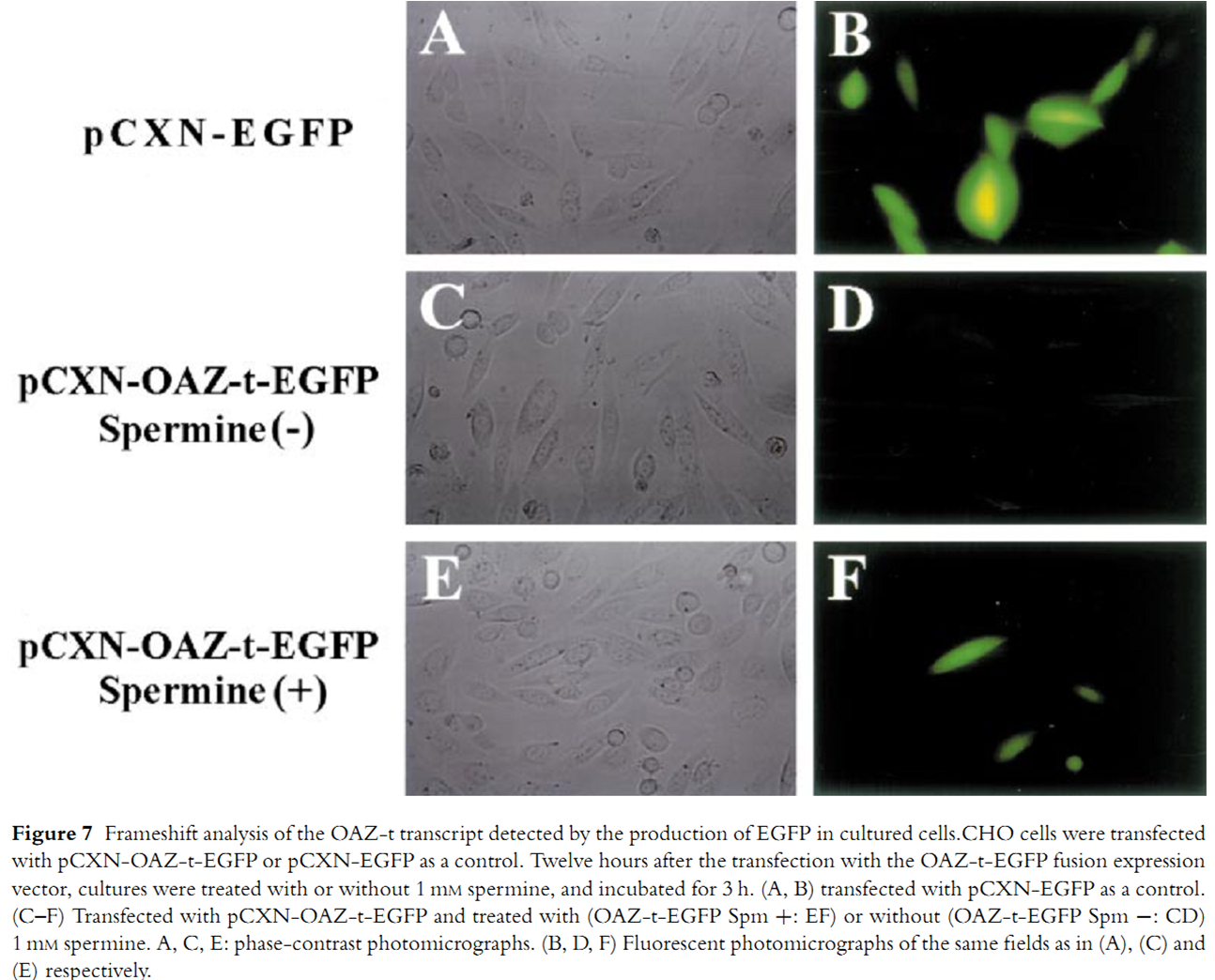 FertilityOnline | Spermatogenes