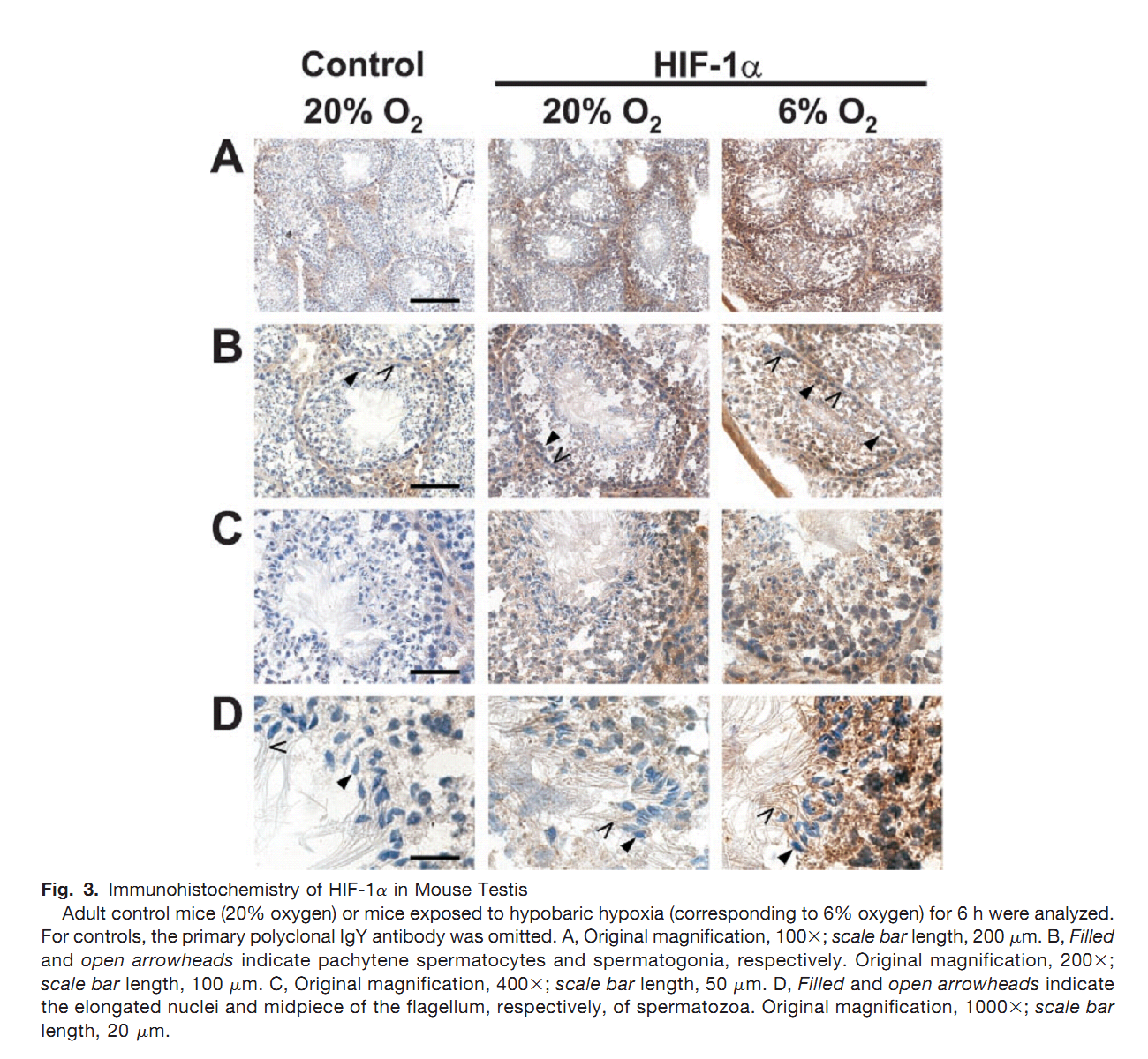 FertilityOnline | Spermatogenes