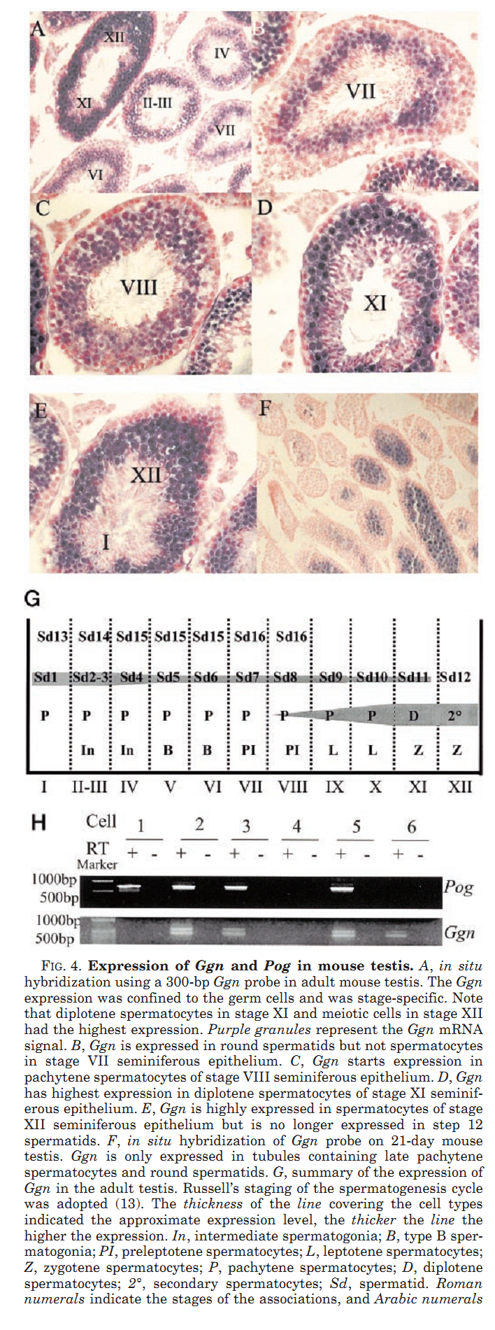 FertilityOnline | Spermatogenes