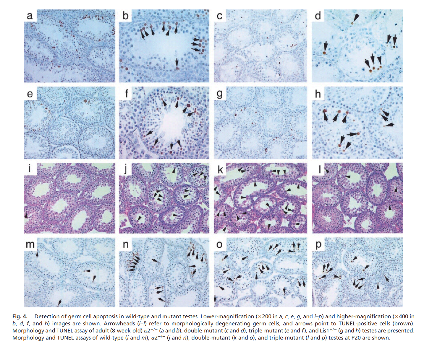 FertilityOnline | Spermatogenes