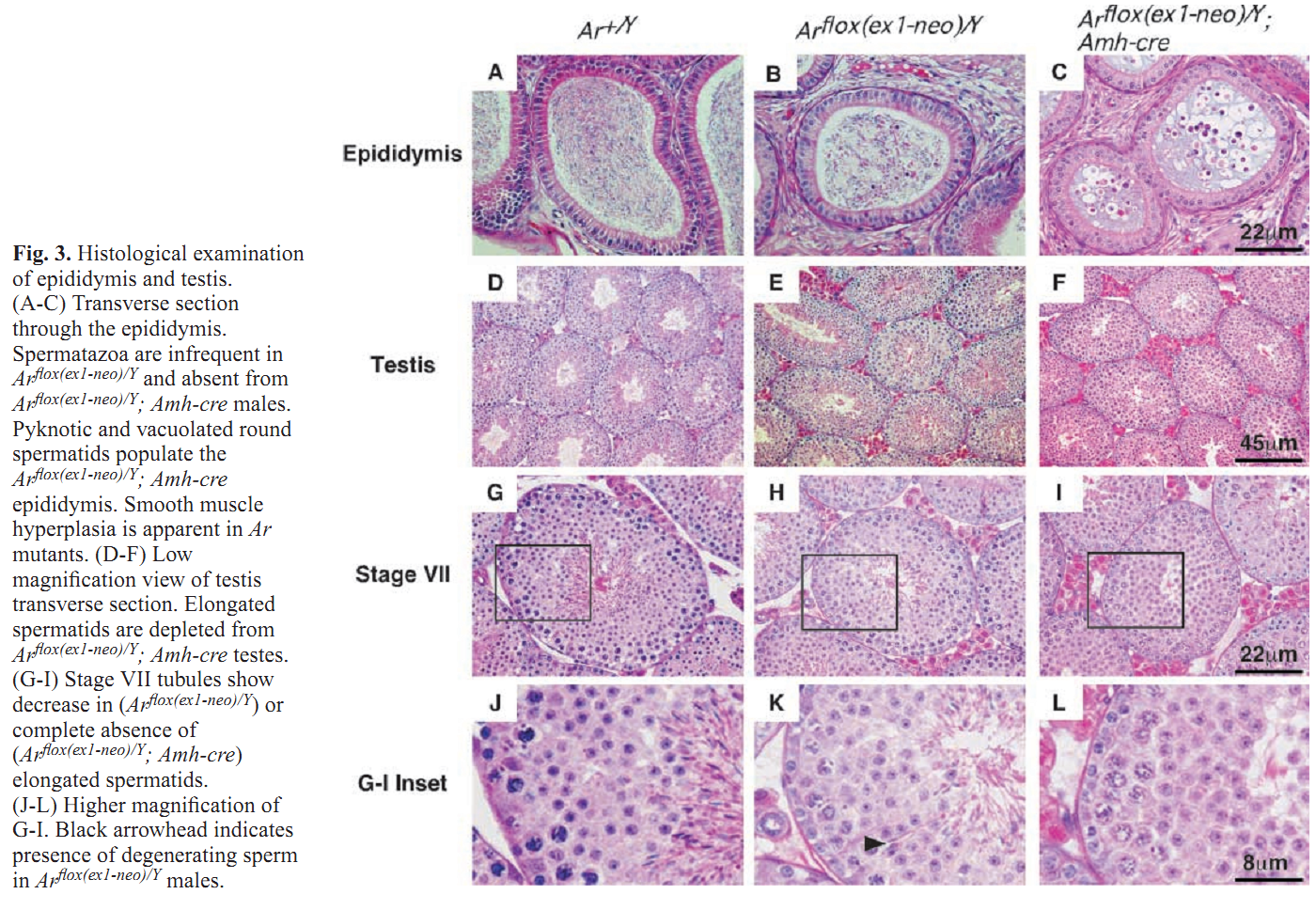 FertilityOnline | Spermatogenes