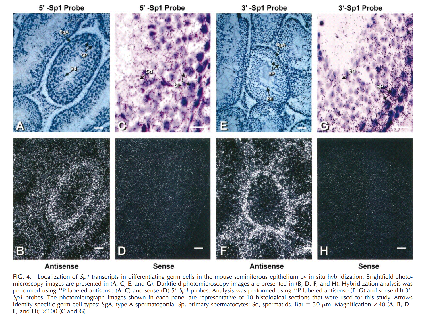 FertilityOnline | Spermatogenes