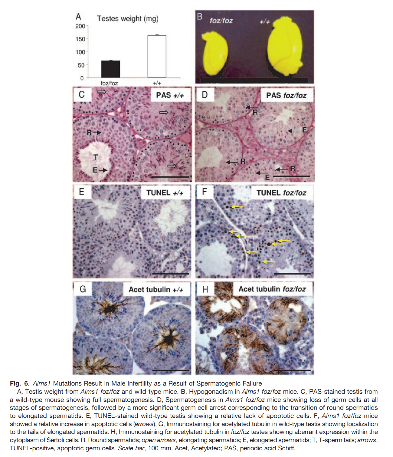 FertilityOnline | Spermatogenes