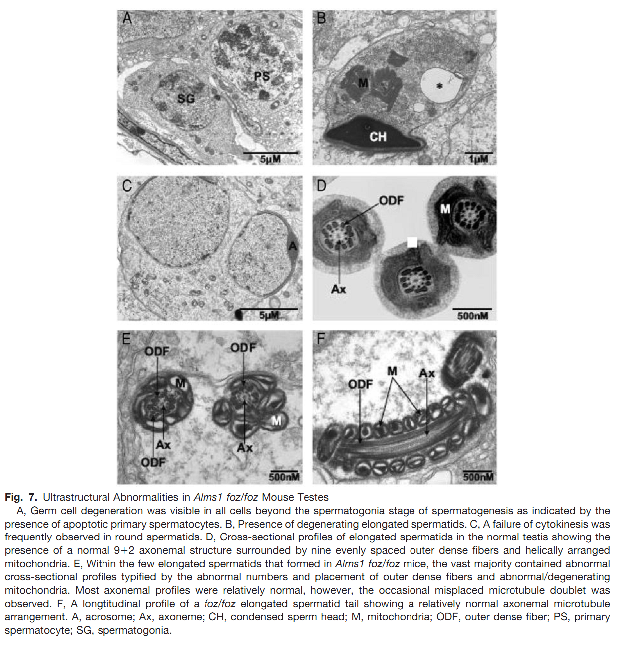 FertilityOnline | Spermatogenes