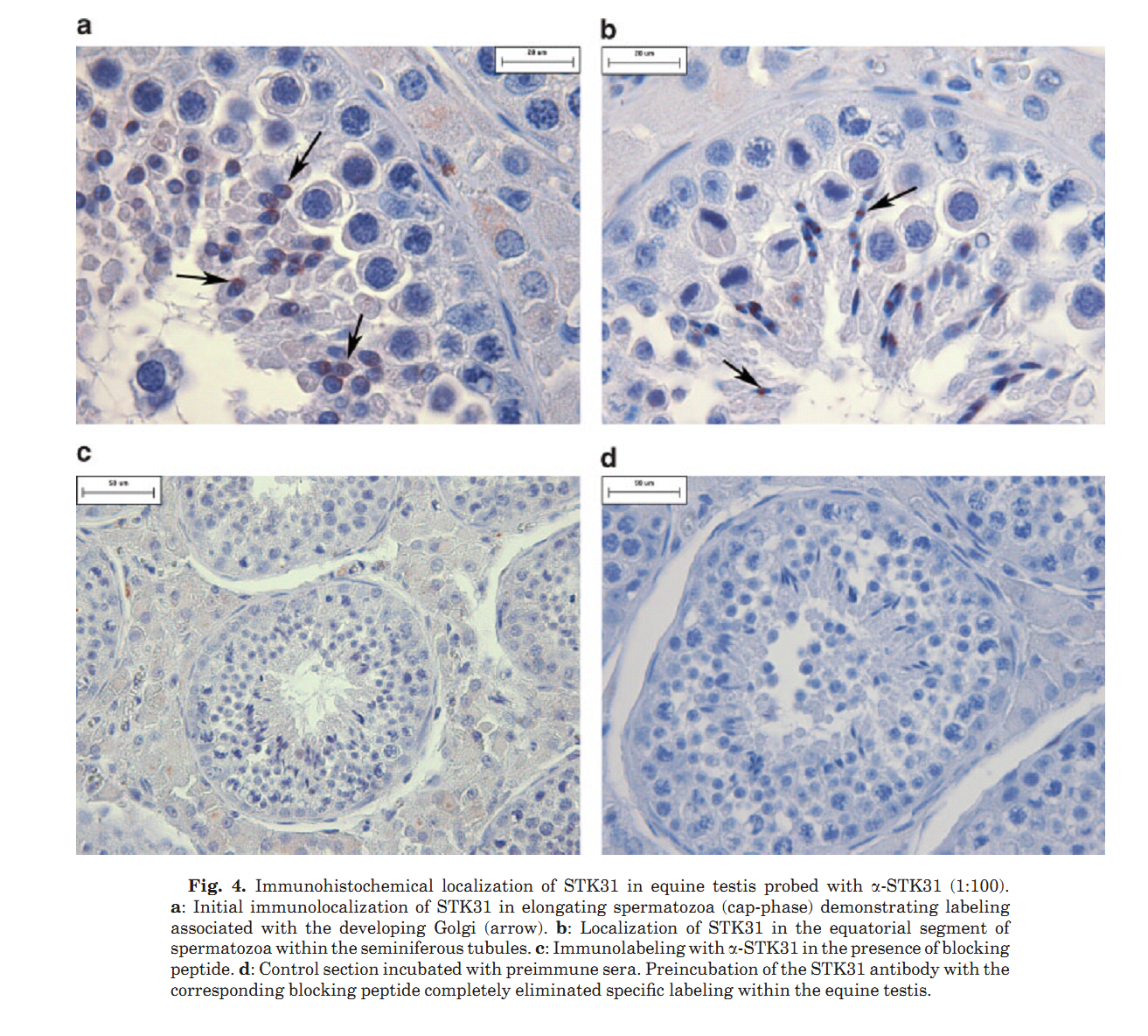 FertilityOnline | Spermatogenes