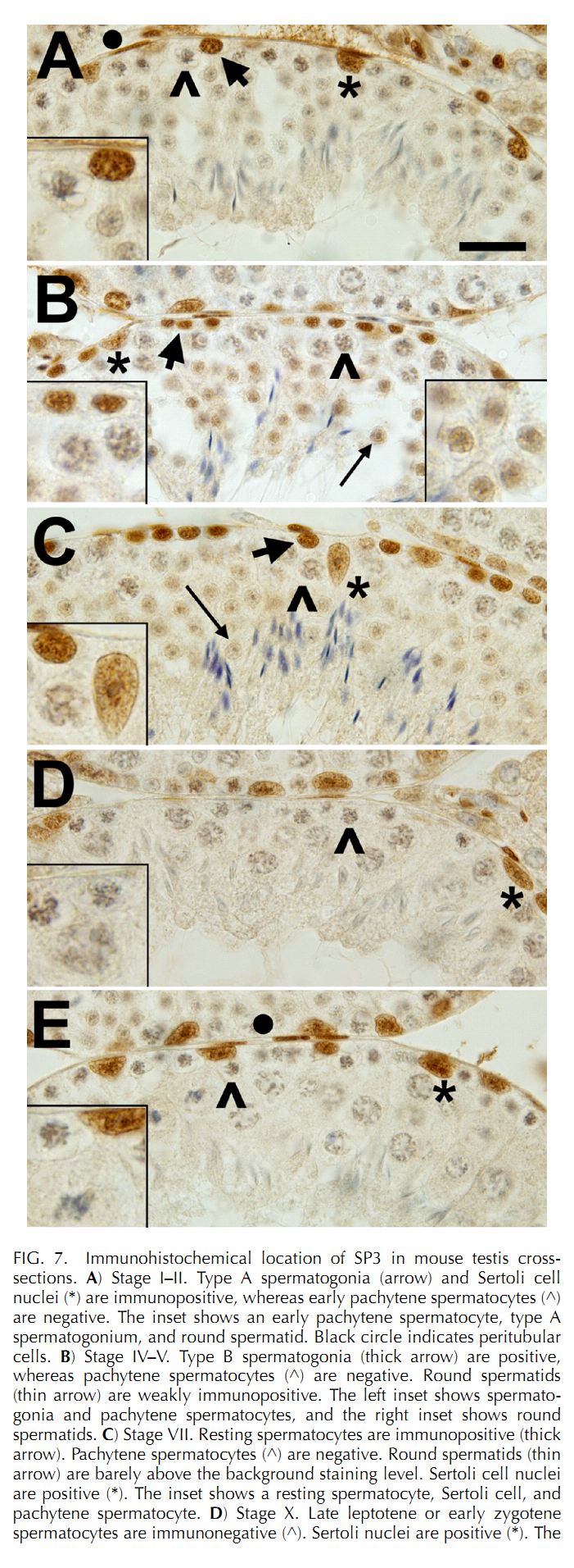 FertilityOnline | Spermatogenes