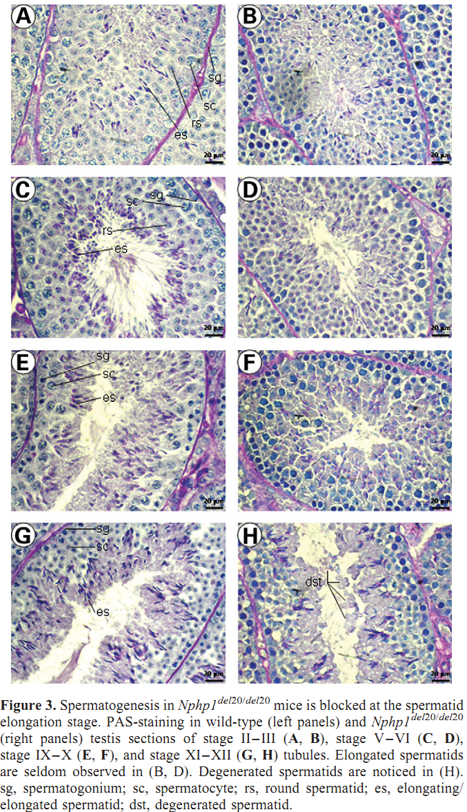 FertilityOnline | Spermatogenes