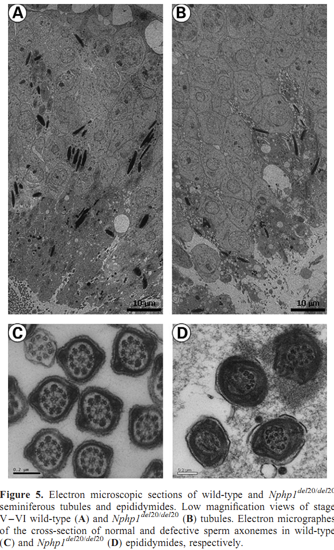 FertilityOnline | Spermatogenes