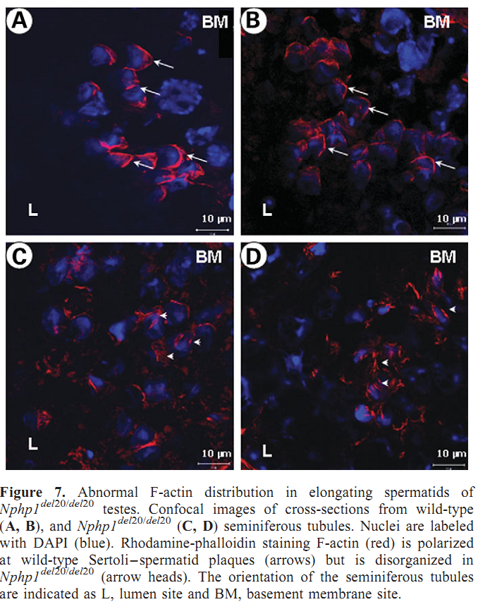 FertilityOnline | Spermatogenes