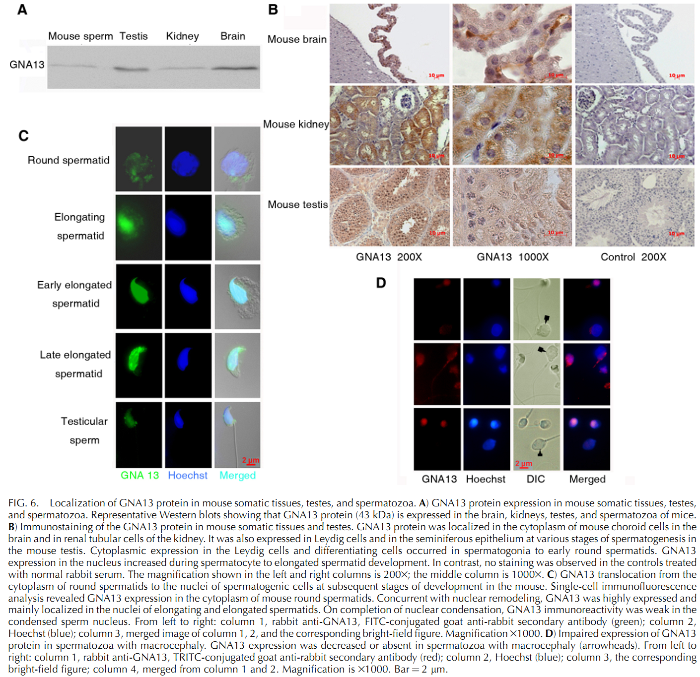 FertilityOnline | Spermatogenes