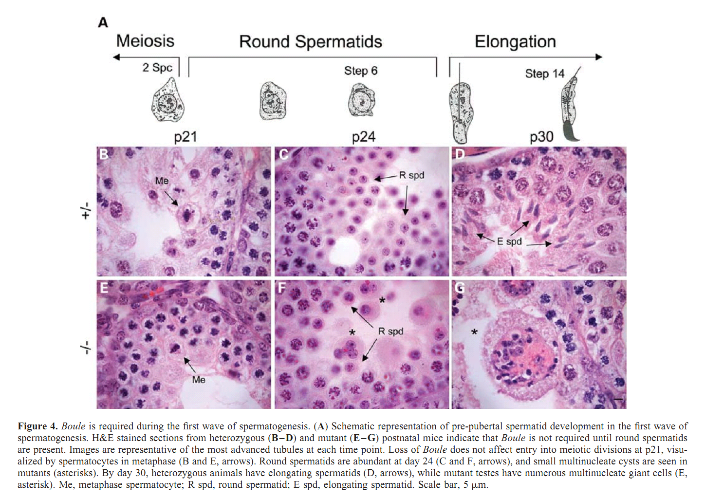 FertilityOnline | Spermatogenes