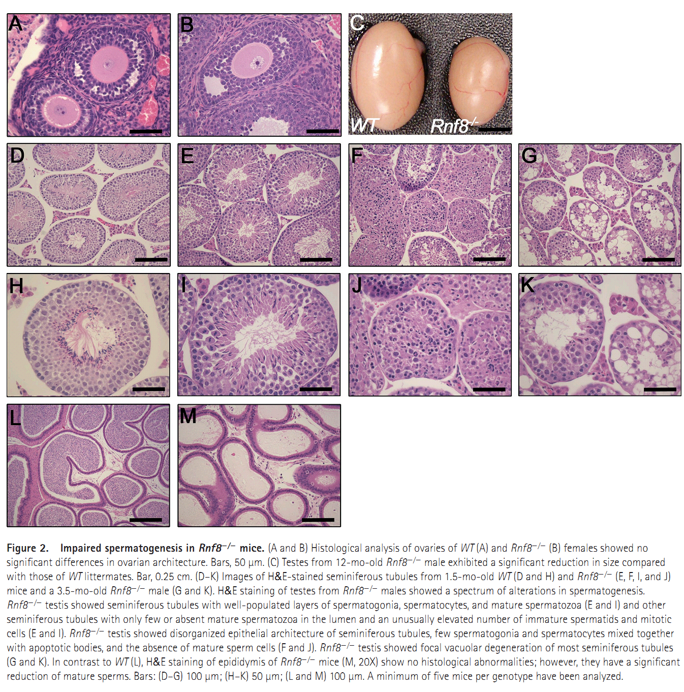 FertilityOnline | Spermatogenes