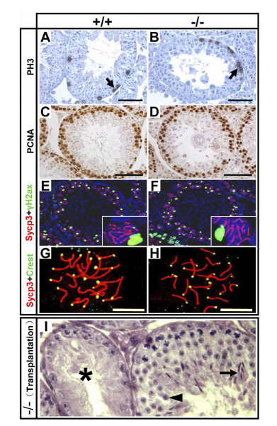 FertilityOnline | Spermatogenes