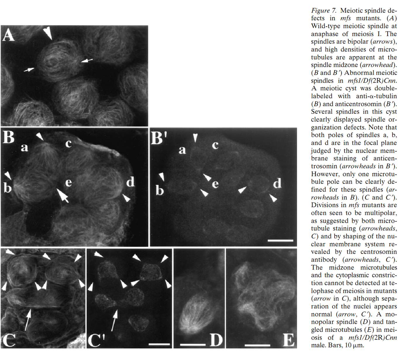 FertilityOnline | Spermatogenes