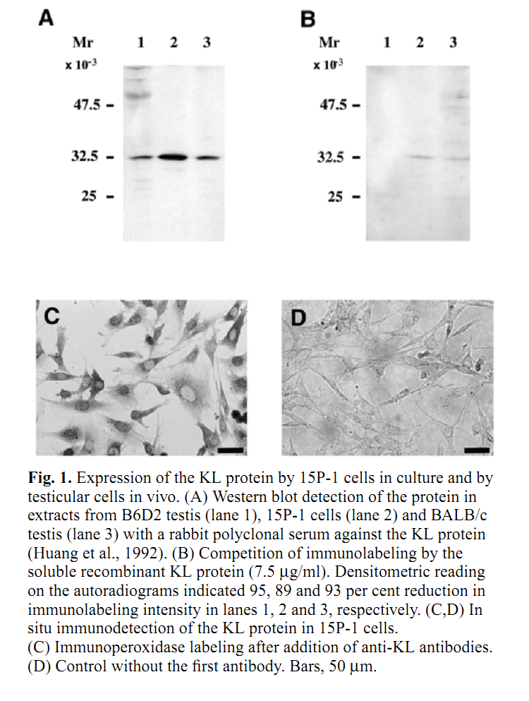 FertilityOnline | Spermatogenes
